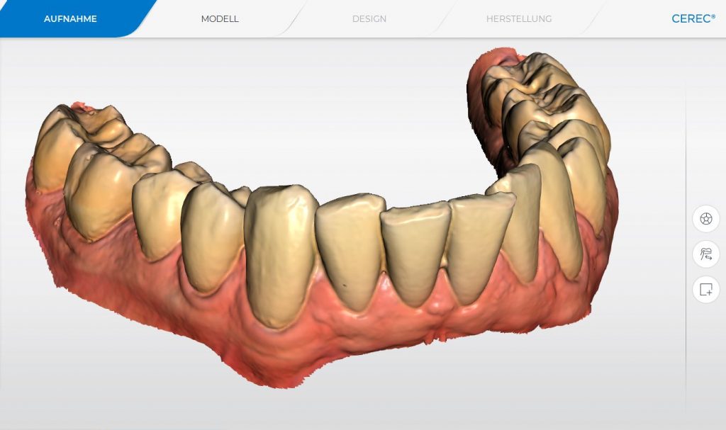 Cerec 3D - Zahnarztpraxis Hey, Laboe / Kiel